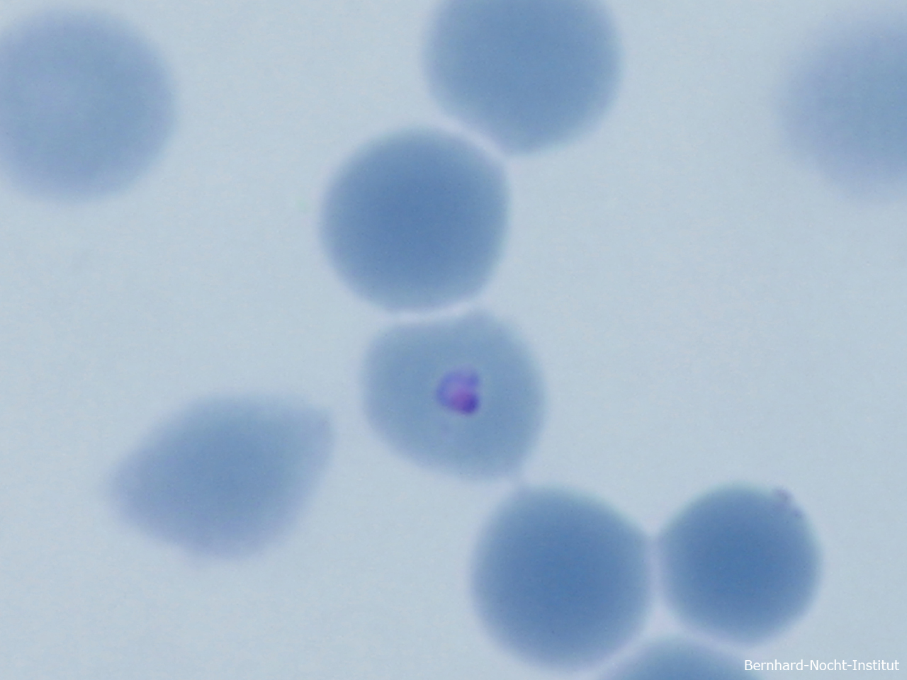 Plasmodium knowlesi (Blutausstriche, Kultur)