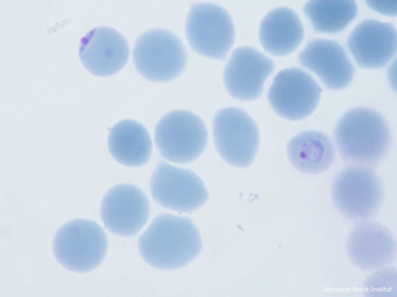 Plasmodium knowlesi (Blutausstriche, Kultur)