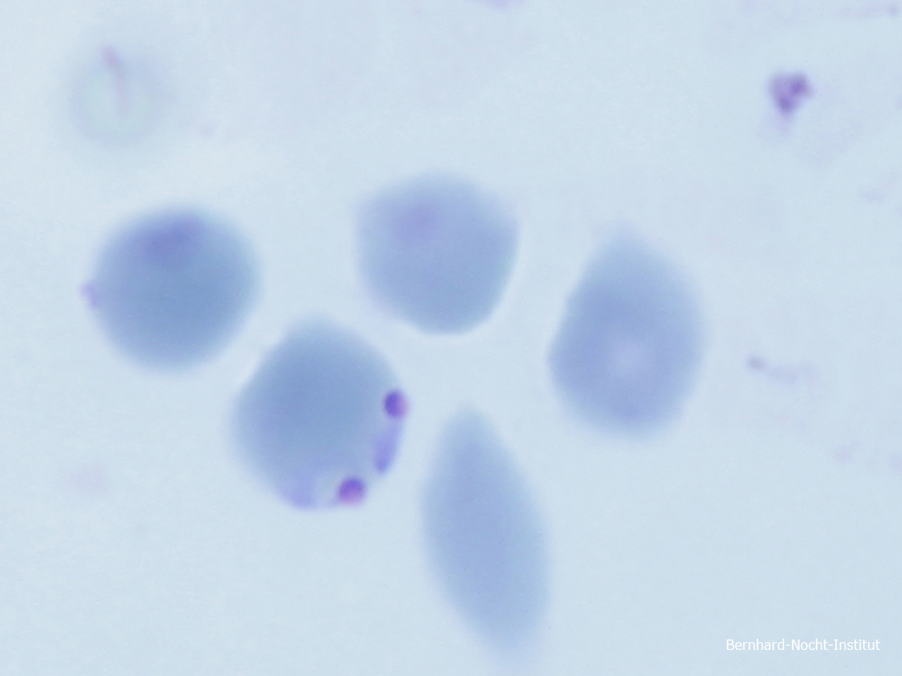 Plasmodium knowlesi (Blutausstriche, Kultur)