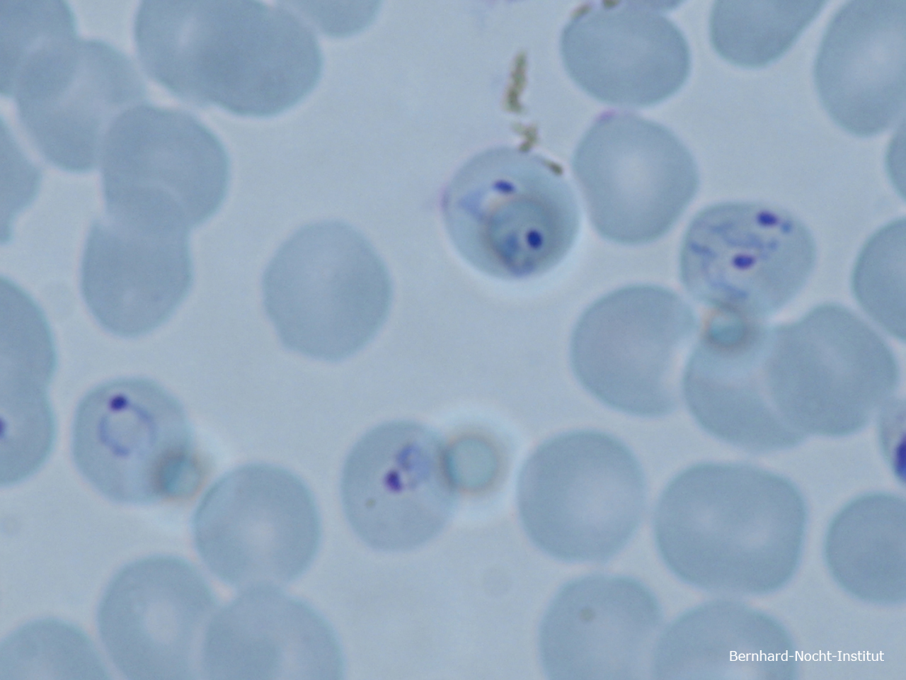 Plasmodium knowlesi (Blutausstriche, Kultur)